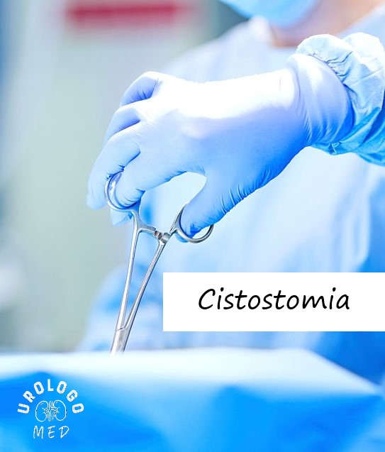 Cistostomia: dalla procedura alla vita dopo - UrologoMed